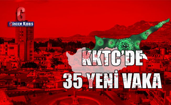 35 pozitif vakaya rastlandı - Gündem Kıbrıs Gazetesi - Kıbrıs Haber