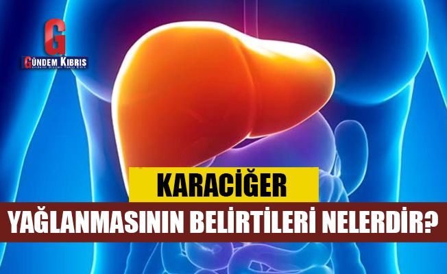 Karaciğer yağlanmasının belirtileri nelerdir? - Gündem Kıbrıs Gazetesi ... Karaciğer yağlanmasının belirtileri nelerdir? - Gündem Kıbrıs Gazetesi ...